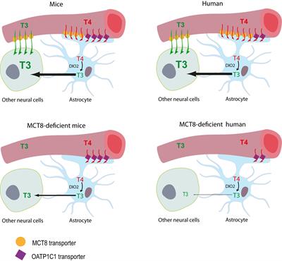 Frontiers | MCT8 Deficiency: The Road to Therapies for a Rare Disease